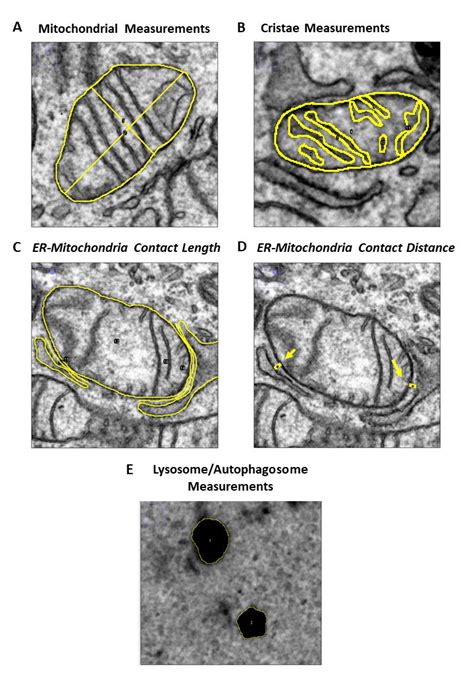 Analyzing Organelle Morphology With Imagej A Representative Tem
