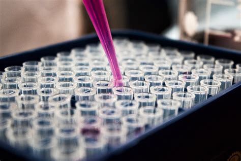 Why Is Bioinformatics Important In Genetic Research