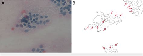 Figure 1 From The Goodness Of Fit Of The Fractal Dimension As A Diagnostic Factor In Breast