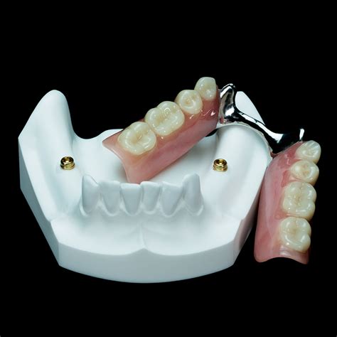 Removable Partial Denture Mandibular