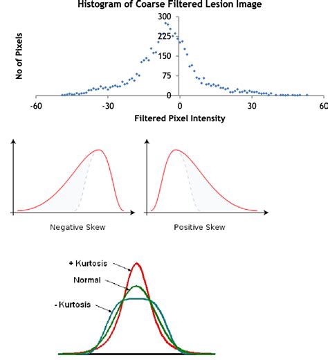Illustration Of Texture Quantification Using A Histogram Based