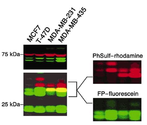 Multiplexing Activity Based Proteomics Probes Human Breast Cancer Cell Download Scientific