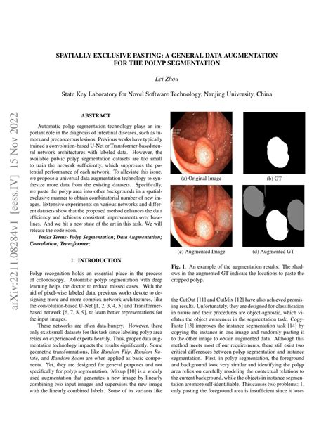 PDF Spatially Exclusive Pasting A General Data Augmentation For The