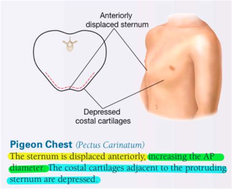 T M Intro Posture Shoulder Scapula ROM And MMT Flashcards Quizlet