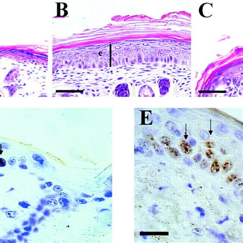 Hyperplasia And Increased Cell Proliferation In Dsc1 Deficient