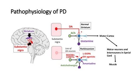 Psychosis In Parkinsons Disease