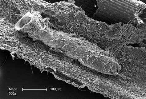 Scanning Electron Microscopy Protists