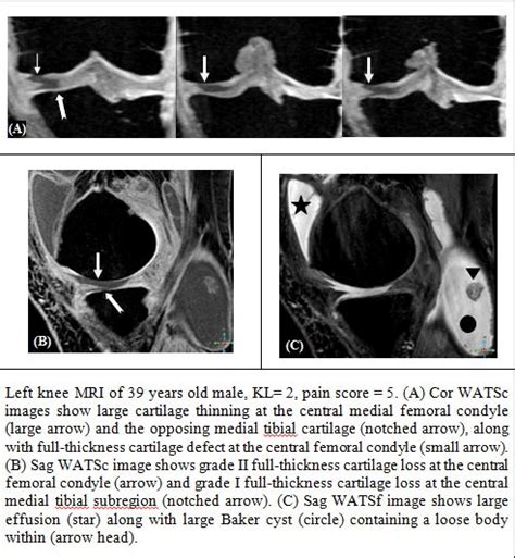 MD Thesis Original Source Of The Article Download Scientific Diagram