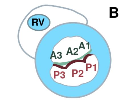 File MV PSAX Svg Echopedia