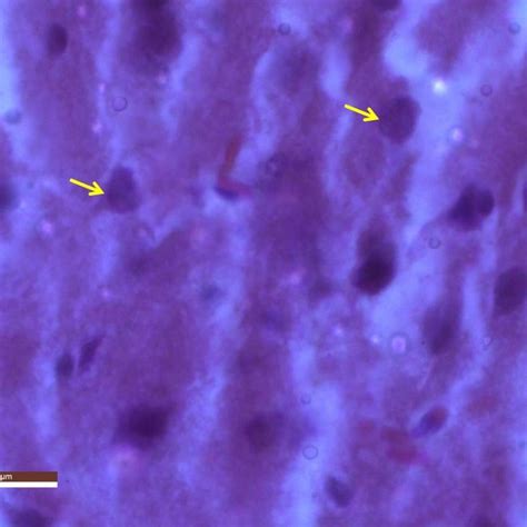 T S Of Cerebral Cortex Of Group Iii Rat Treated With 200 Ppm Sodium Download Scientific