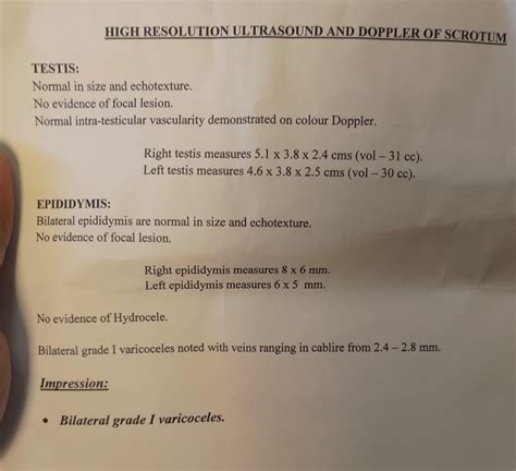 Bilateral Grade 1 Vericocele R Varicocele