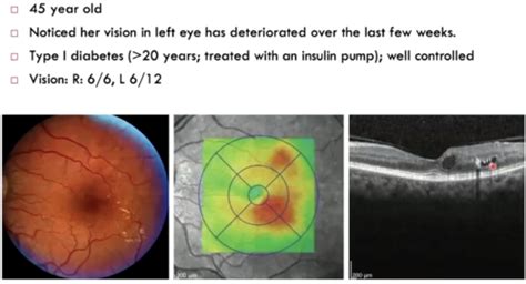 Week 2 Lectures Flashcards Quizlet