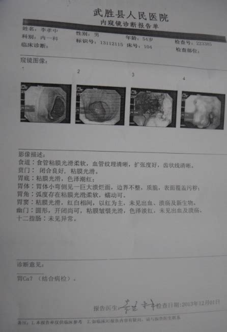 胰腺癌晚期粪便图片 胰腺癌大便图白色 伤感说说吧