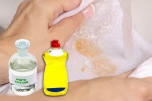 How To Remove Old Stains From White Clothes