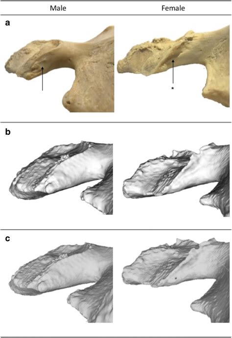 Bone Sulcus