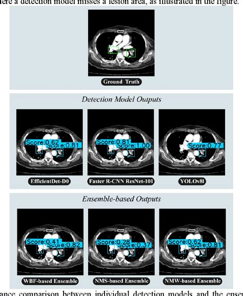 figure 1 from deep learning in computed tomography pulmonary angiography imaging a dual pronged