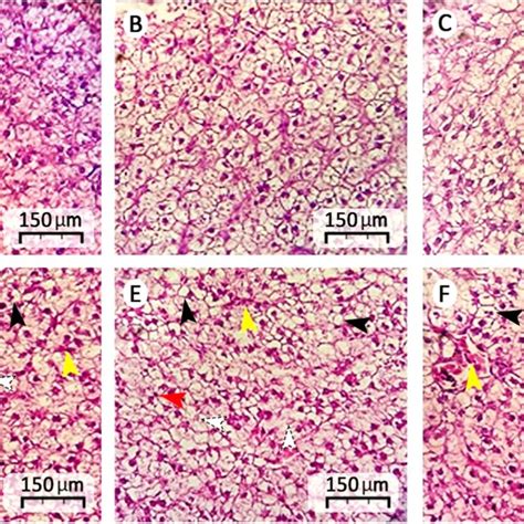 Microphotographs Of Common Carp Cyprinus Carpio Liver After Exposure