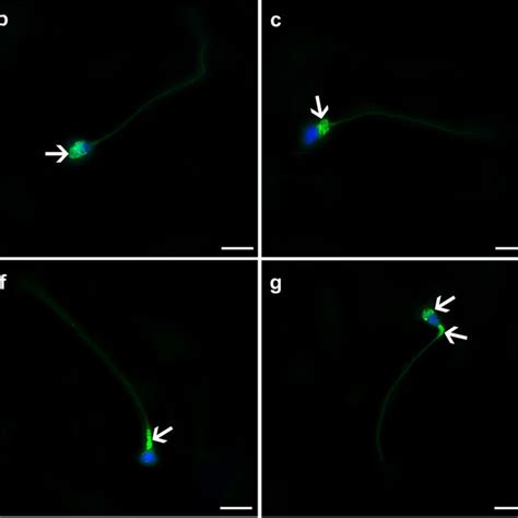 Immunofluorescence Staining Patterns Of Syncytins And Their Receptors Download Scientific