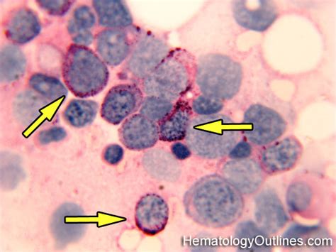 Hematologyoutlines Atlas