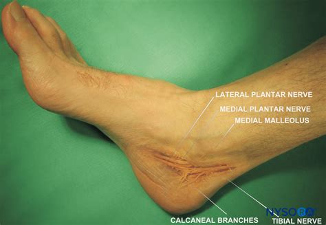 Tibial Nerve The Lateral Plantar Nerve Dr Nabil Ebraheims Blog