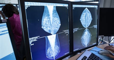 Svårt Med Sex För Unga Kvinnor Med Cancer