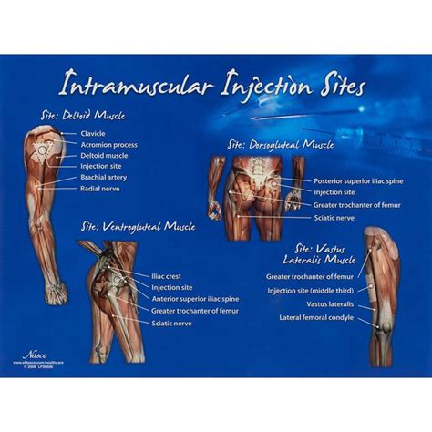 Ventrogluteal Self Injection