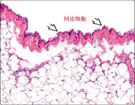 【衡道丨干货】病理基础——浆膜腔脱落细胞学 Medsci Cn