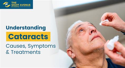 Cataracts Causes Symptoms And Treatment Tsa