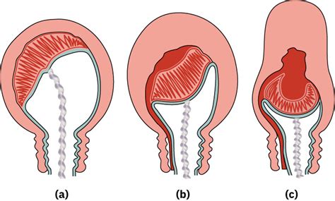 184 Nursing Care During The Third Stage Of Labor Medicine Libretexts