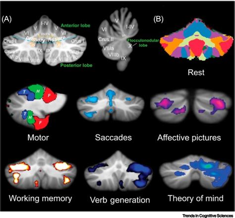 Ignoring The Cerebellum Is Hindering Progress In Neuroscience Trends