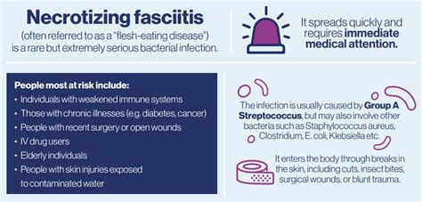 Understanding Necrotizing Fasciitis A Rare But Serious Threat Pal International