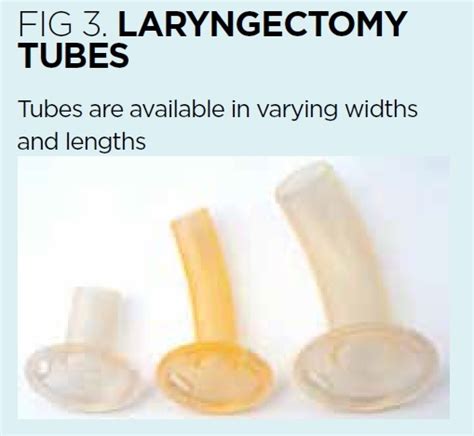Laryngectomy Vs Tracheostomy Neck Stoma Patients Is Vital Information