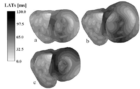 Basal Views Showing The 3d Isochronal Maps Of The Local Activation