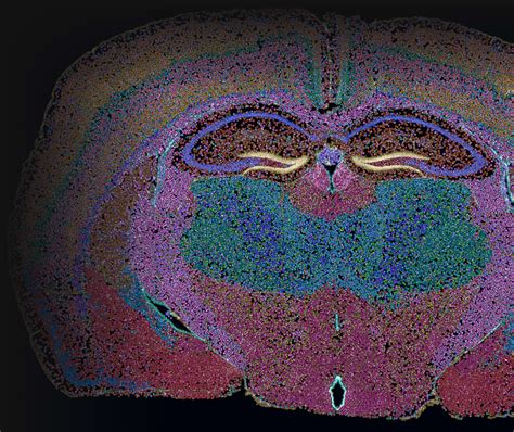 Spatially Resolved Transcriptomics An Introductory Overview Of Spatial Gene Expression