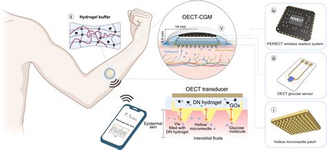 Coin Sized Fully Integrated And Minimally Invasive Continuous Glucose