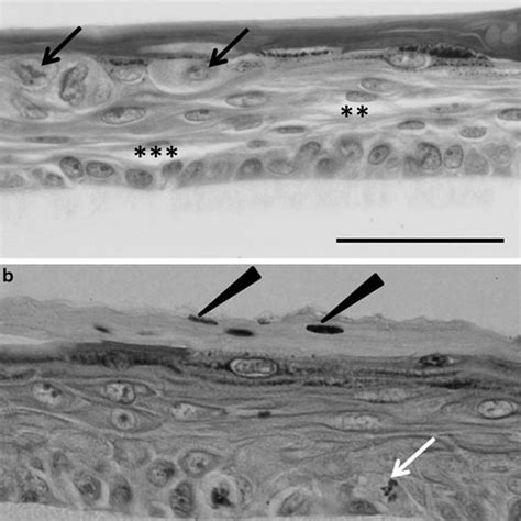 Pdf The Reconstructed Human Epidermis Models In Fundamental Research