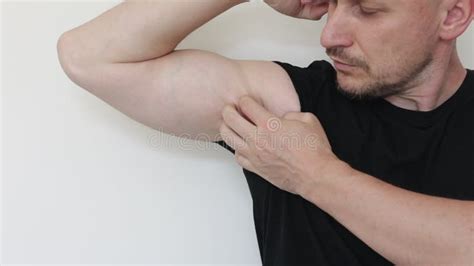 Armpit Rash Cropped Photo Of Irritation Inflammation On Sensitive