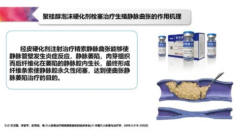 教学ppt丨精索静脉曲张的聚桂醇泡沫硬化剂介入导管栓塞疗法 硬化网