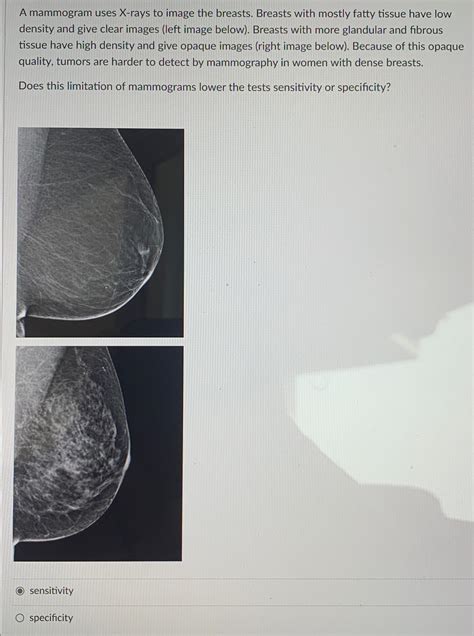 Solved A Mammogram Uses X Rays To Image The Breasts Breasts Chegg Com