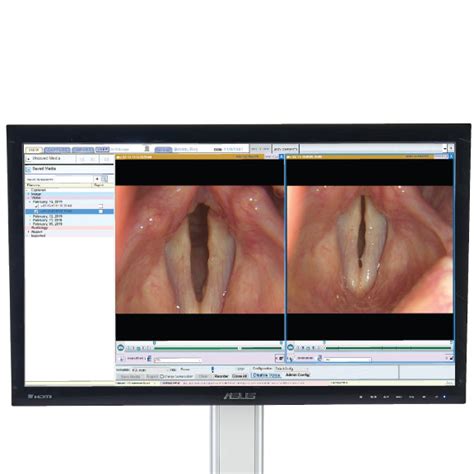 Stroboscopy Ent Jedmed