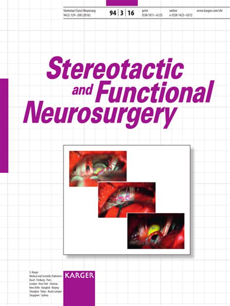 Focal Dystonia In Hemiplegic Upper Limb Favorable Effect Of Cervical Microsurgical Drezotomy