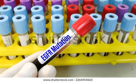 Pcr Egfr Mutation Test Photos Images And Pictures Shutterstock
