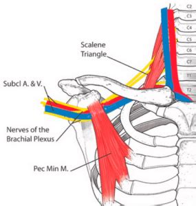 Pec Minor A Babe Muscle Implicated In Big Problems Sydney Physio Clinic