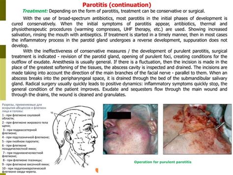 Inflammation Of The Lymph Nodes Blood And Lymph Vessels Inflammation
