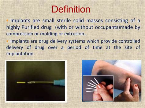 Ndds 6 Implantable Drug Delivery System Pptx