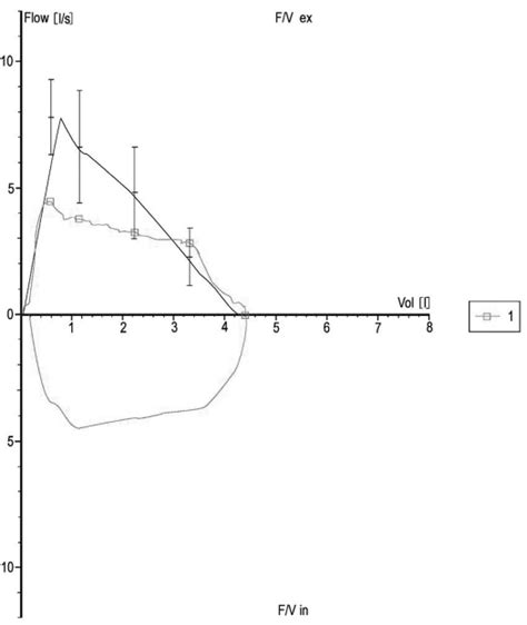 Flow Volume Loop Showing Typical Flow Limitation Due To Download Scientific Diagram