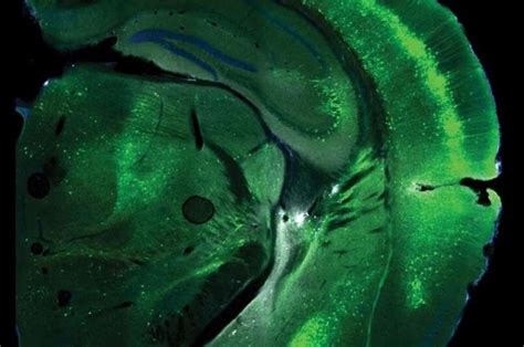 Study Shows That Distinct Pyramidal Cell Types Drive Different Patterns