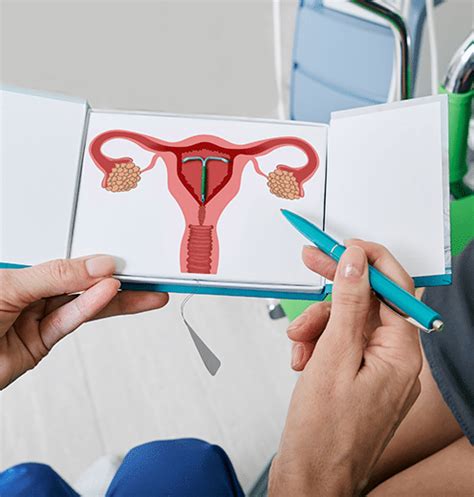 IUD Contraception Info Gynaecology Centres Australia