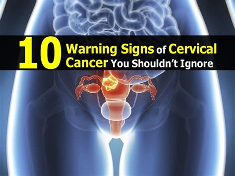 Cervical Cancer Symptoms You Shouldn T Ignore Reader S My Xxx Hot Girl