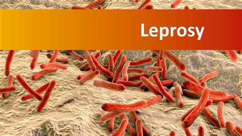 Leprosy Bacteria Structure
